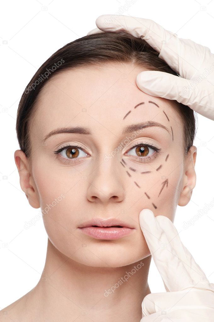 Correction lines on woman face, before surgery operetion Stock Photo by ...