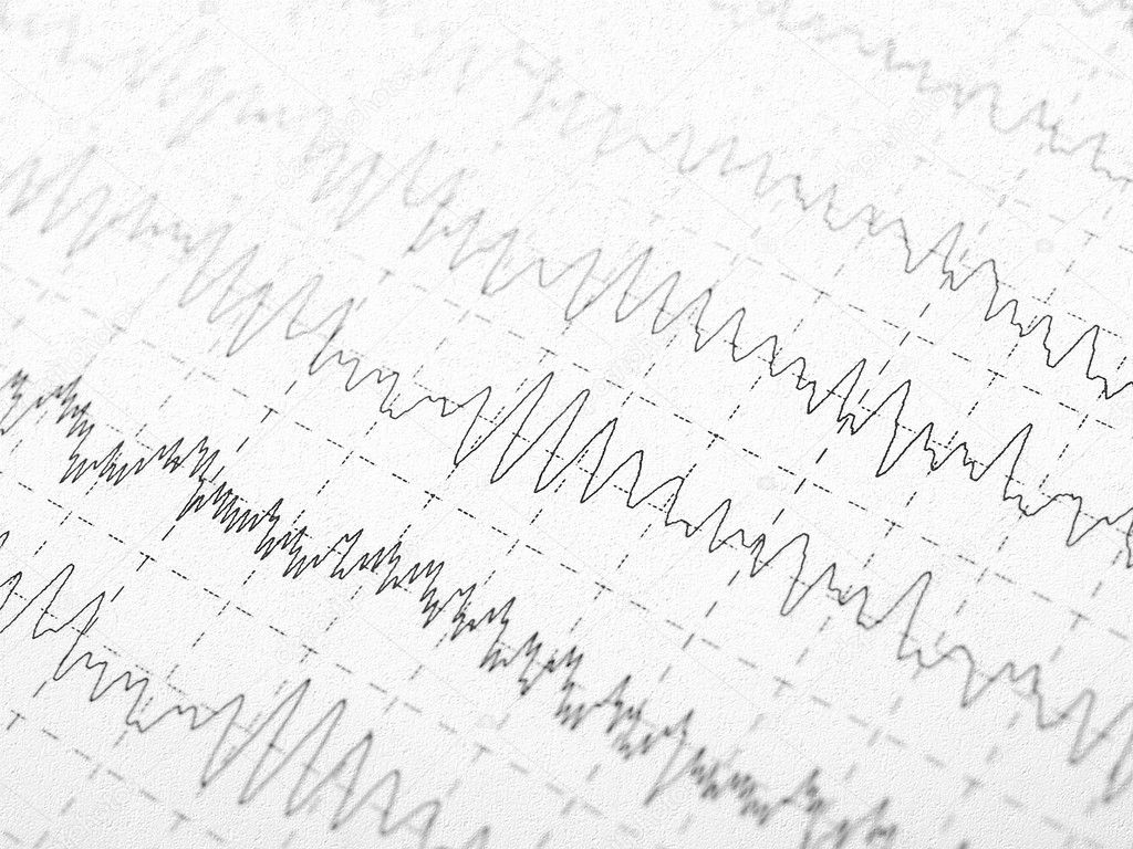 Brain waves on encephalogramme eeg — Stock Photo © dusan964 #10113667
