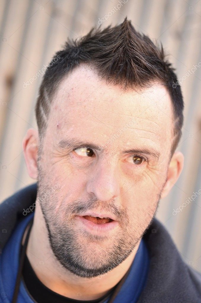 Hombre con síndrome de Down: fotografía de stock © muro #9172665 ...